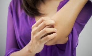 Itchy and Red Bumps on Elbows – Causes and Treatment